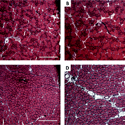 EDL and SOL muscles morphology.