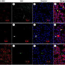Confocal images of infected chicken blood cells stained with anti-red ...