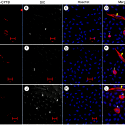 Confocal images of infected chicken blood cells after staining with ...