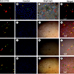 Images of infected chicken blood cells that are stained with anti-CYTB ...