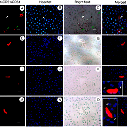Images of infected chicken blood cells that are stained with anti-CD51 ...