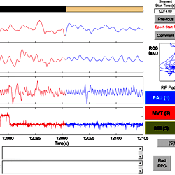 Example of Unknown (UNK).