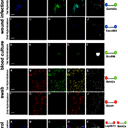 Application of the diagnostic algorithm for the identification of ...