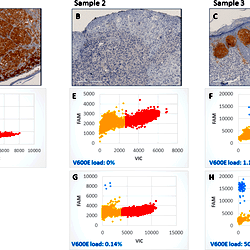 Immunohistochemistry (IHC) and digital PCR (dPCR) results from 3 samples.