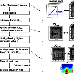 Block diagram of the motion compensation algorithm.