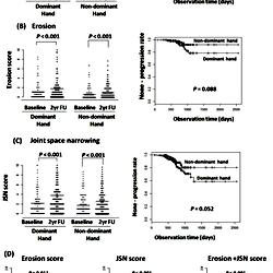 Hand total, erosion and joint space narrowing (JSN) van der Heijde ...