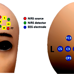 Toward a compact hybrid brain-computer interface (BCI): Performance ...