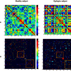 Brain region functional network: visualization of the correlation ...