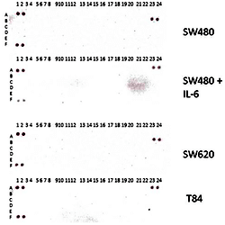 Human phosphor-receptor tyrosine kinase array of SW480, SW620 and T84.
