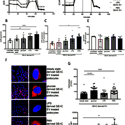 Measurement of OCR of podocytes stimulated with steady state, glucose ...