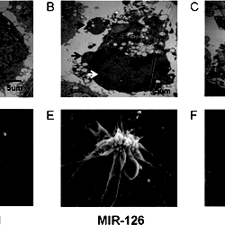 Cell morphology analysis using electron microscopy demonstrates apoptosis.