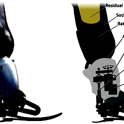 Schematic of bionic dancing prosthesis.