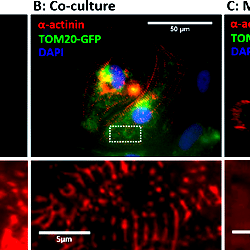 Staining of AICS11 (TOM20-GFP) cells for sarcomeric α-actinin.