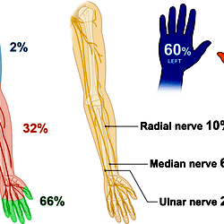 Acute and long-term costs of 268 peripheral nerve injuries in the upper ...