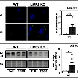Assessment of autophagy following EBSS in RPE.
