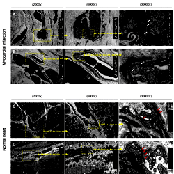 Electron microscopy analysis of the peri-infarction area prior to HMGB1 ...
