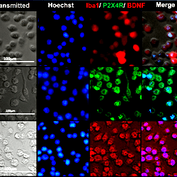 Iba1, BDNF and P2X4R detection using immunocytochemistry (ICC).