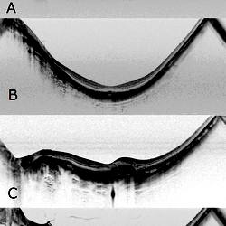 Representative horizontal scans of SS-OCT.