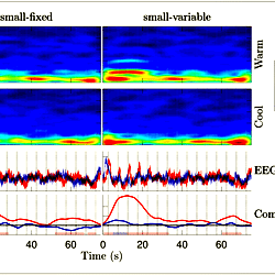 EEG time-frequency analysis.
