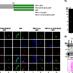 Human TRIT1 contains an N-terminal mitochondrial targeting sequence (MTS).