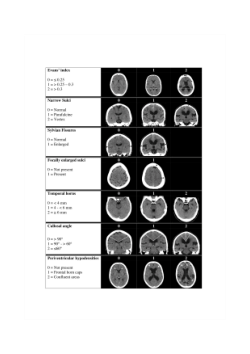 iNPH Radscale atlas.