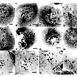 Acetocarmine staining of spo11-1-1 meiocytes during meiosis I.