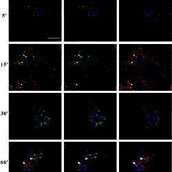 The localisation of EEA1 and Lamp1 during EGFR endocytosis.