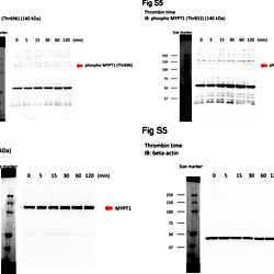Original uncropped and unadjusted images of immunoblots of Fig 4D.