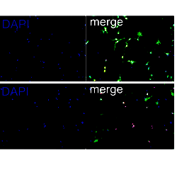 OPC proliferation after NG2 knock-down.