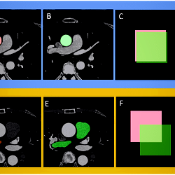 Dice score visualization.