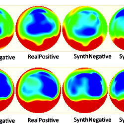 A topographic heat map of the entire scalp for both the P1 and N1 in ...