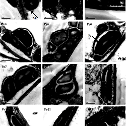 Chloroplast ultrastructural characters in the mesophyll cells of P ...