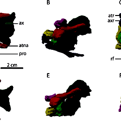 Details of the atlas-axis complex revealed by segmentation of CT image ...