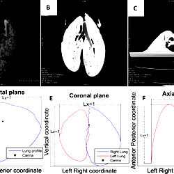 Normalized contour lines obtained from CT-scan images.