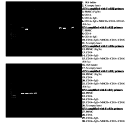Uncropped Fig 3A gel images of FcεRI α, β, and γ subunit genes.
