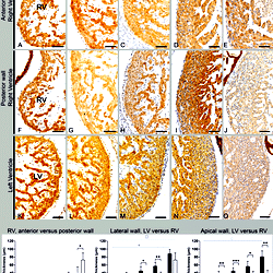 Ventricular compaction and wall thickness in sequential stages E11.5–15.5.