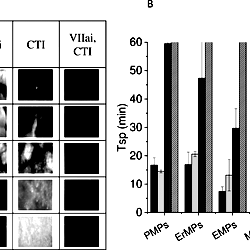 Activation pathway from MPs.