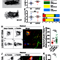 Abnormal MT dynamics and stability in HUVEC with reduced LGN.