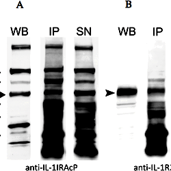 A) Western blot (WB), immunoprecipitation (IP), and supernatants (SN ...