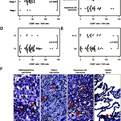 Immunohistochemical analysis and quantification of CD68-positive cells ...