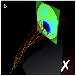 3D Vortex Core Detection.