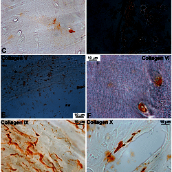 Immunohistochemistry of the different collagen subtypes.