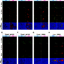 The pH sensitivity of mKeima-LC3B.