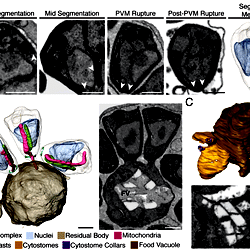 The basal end and food vacuole.