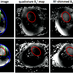Representative B1+ maps and ROI placement.