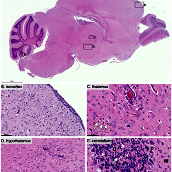 Hematoxylin and eosin-stained sections of brain from a mouse inoculated ...