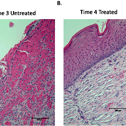 Representative histology images.