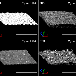 Confocal microscopy.
