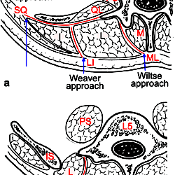 Illustration showing transverse sections at different levels of the ...