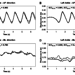 Representative ankle time series of the multi-Kinect v2 set-up and the Optotrak system.